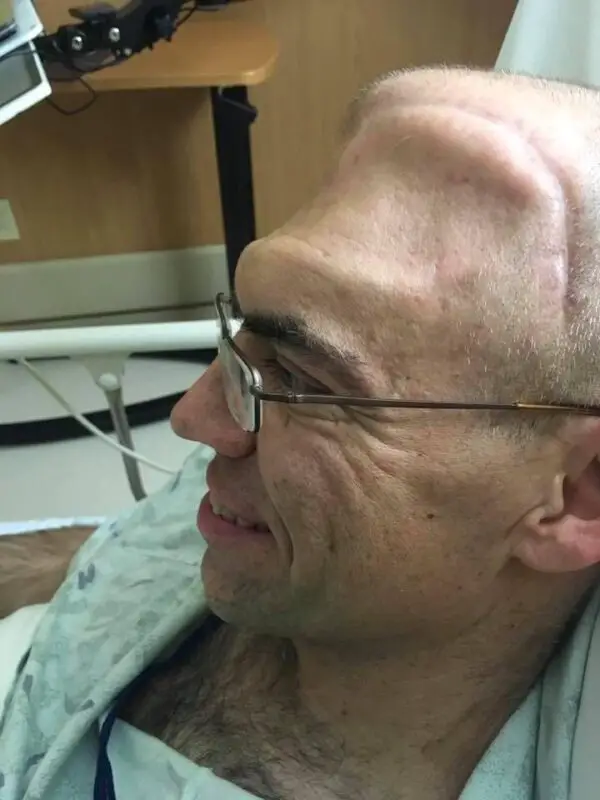 Michael Moyles Brain Cancer: Expected To Survive For 6 Years, Yet He ...